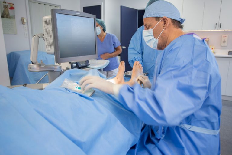 Opération des varices : Déroulement, coûts, conseils et FAQ